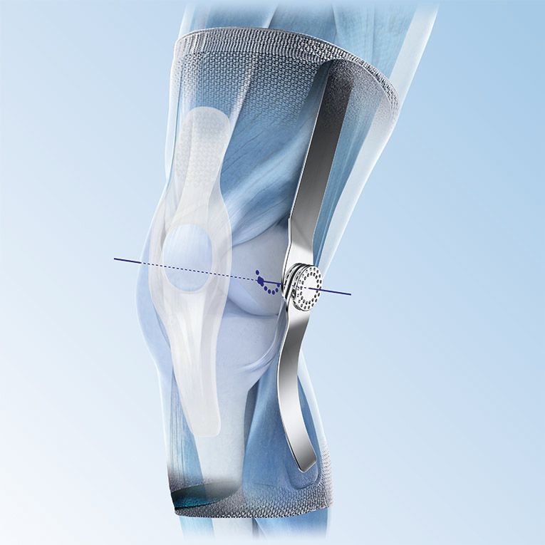 Bauerfeind SofTec Genu Kniebrace | Podobrace