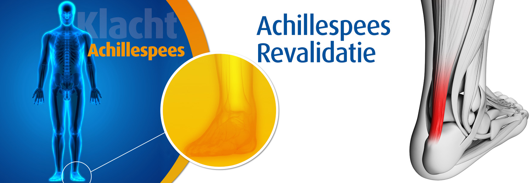 Achillespees Revalidatie na ruptuur | Podobrace