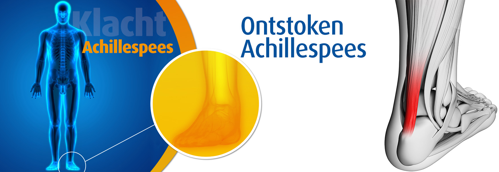 Ontstoken achillespees? Dit moet je doen | Podobrace