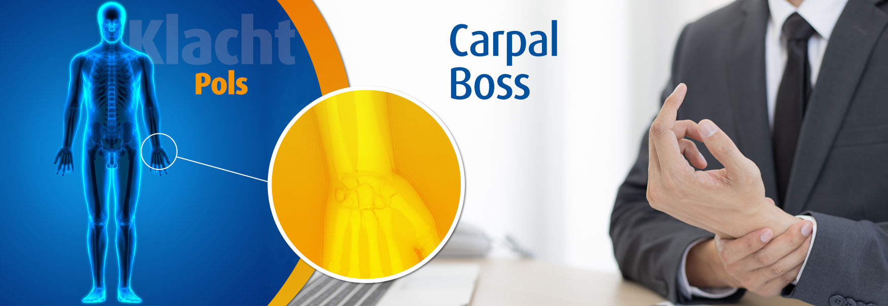 Carpal Boss: Wat is het precies? | Podobrace