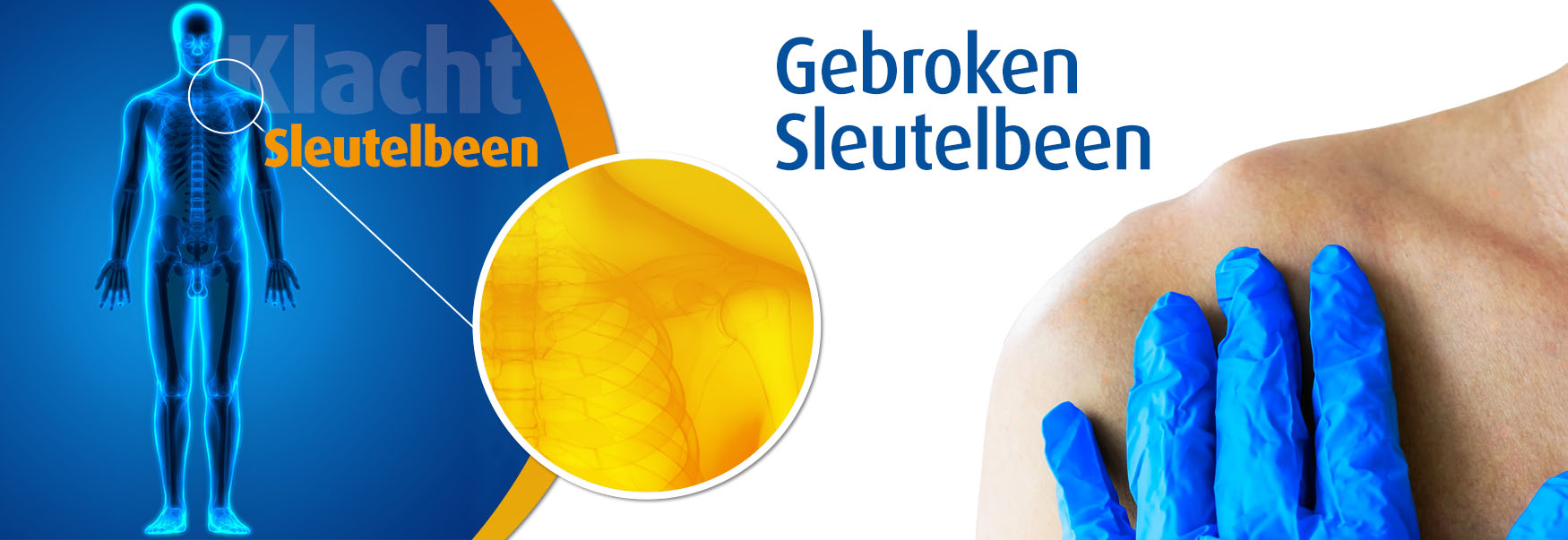 Gebroken sleutelbeen? Informatie & behandeling | Podobrace